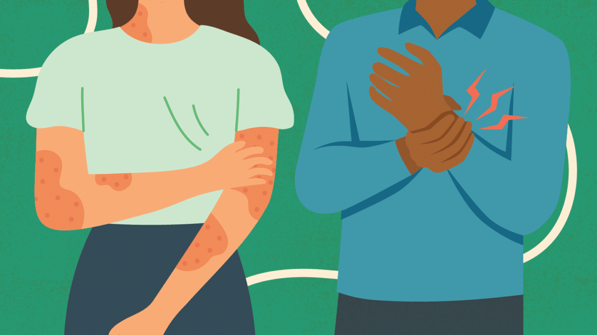 What to know about psoriasis, psoriatic arthritis, and brain fog - Med ...